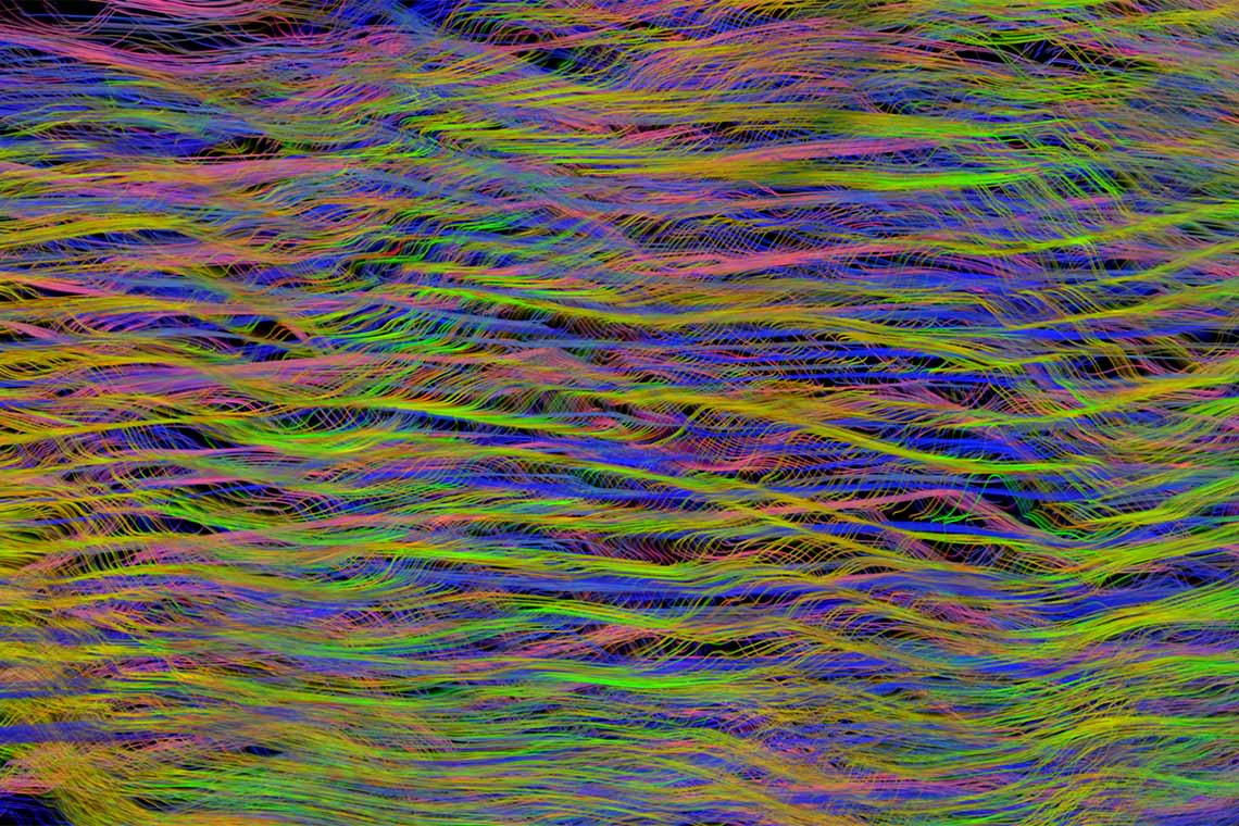 Krista Kim – Canvas